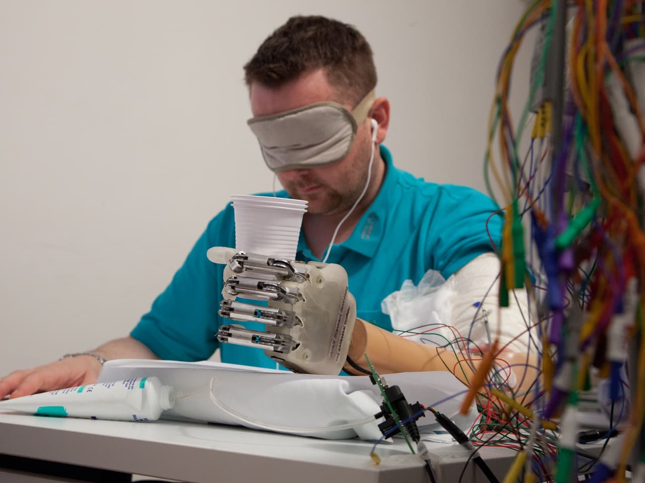 Technik - Erste Handprothese mit Tastsinn - Wissen - SRF