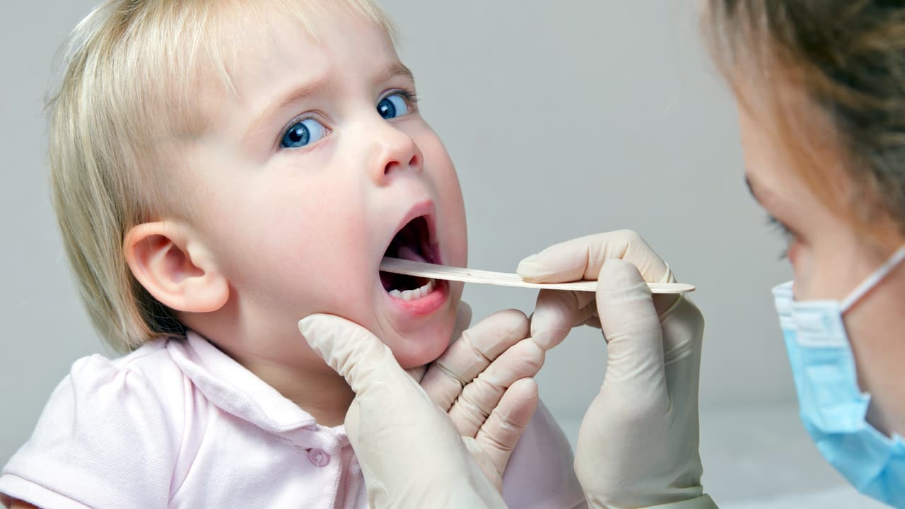 Mandelentzündung - Hausmittel bei Angina und wann man zum Arzt sollte ...