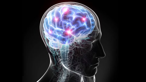 Experiment in den USA - Gedanken entschlüsseln dank Hirn-Scans und KI ...