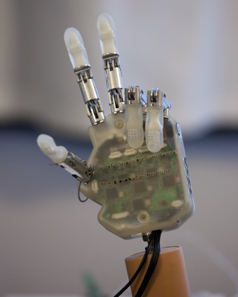 Technik - Erste Handprothese mit Tastsinn - Wissen - SRF