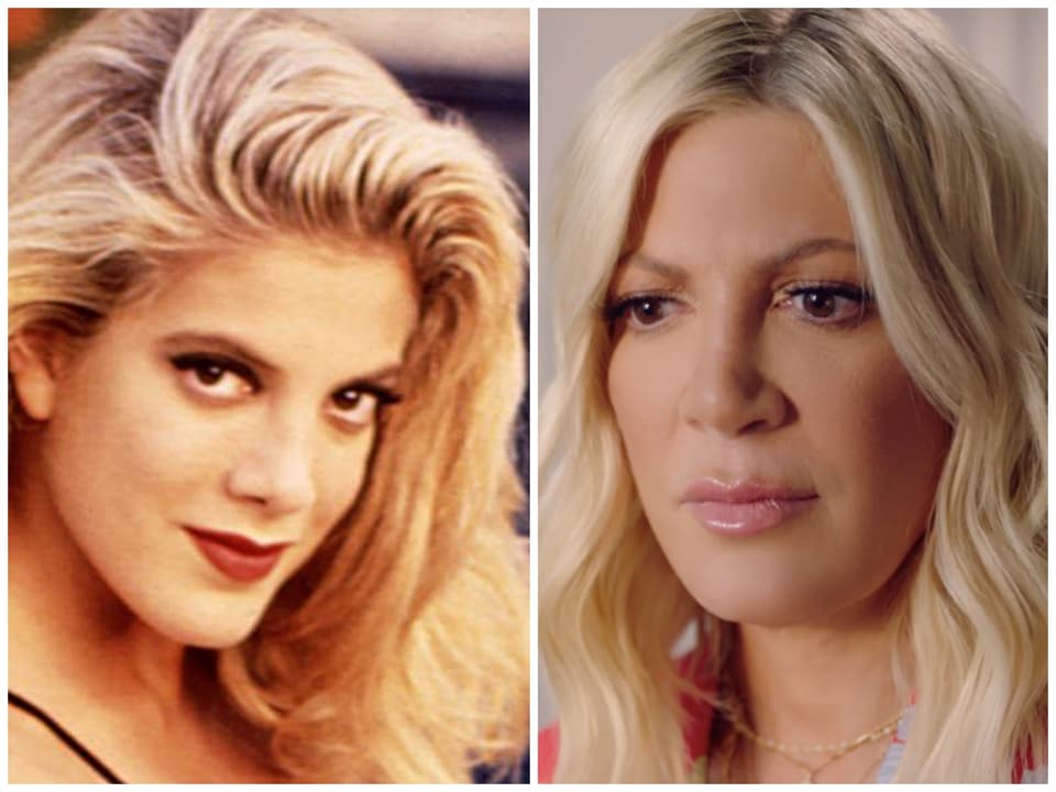 «Beverly Hills, 90210»-Remake - Dieses Facelifting verdirbt den alten ...