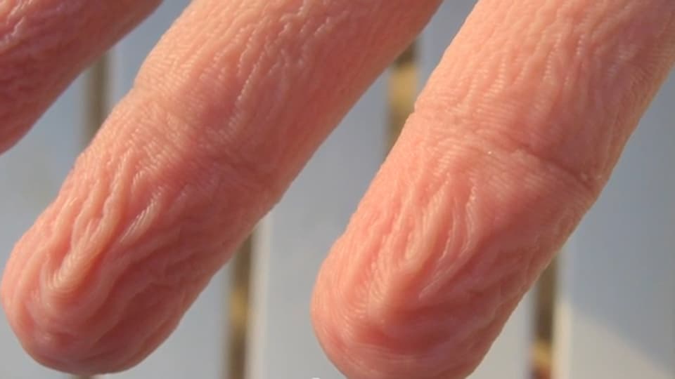 Fünfmalklug - Haben Schrumpelfinger auch ihr Gutes? - Einstein - SRF