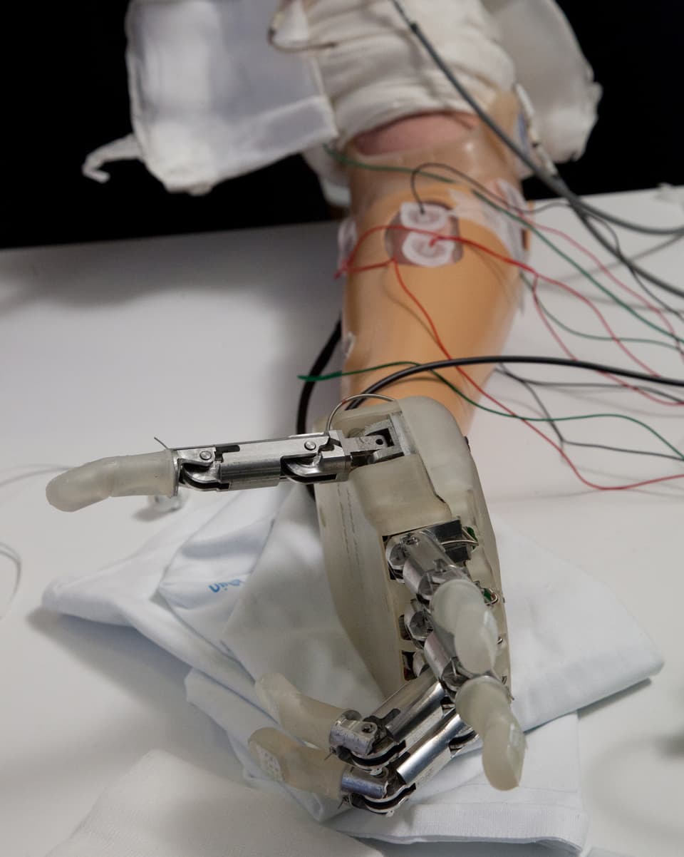 Technik - Erste Handprothese mit Tastsinn - Wissen - SRF