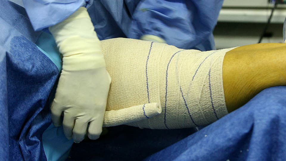 Unnötige Arthroskopien - Experten raten von Knie-Operationen ab ...