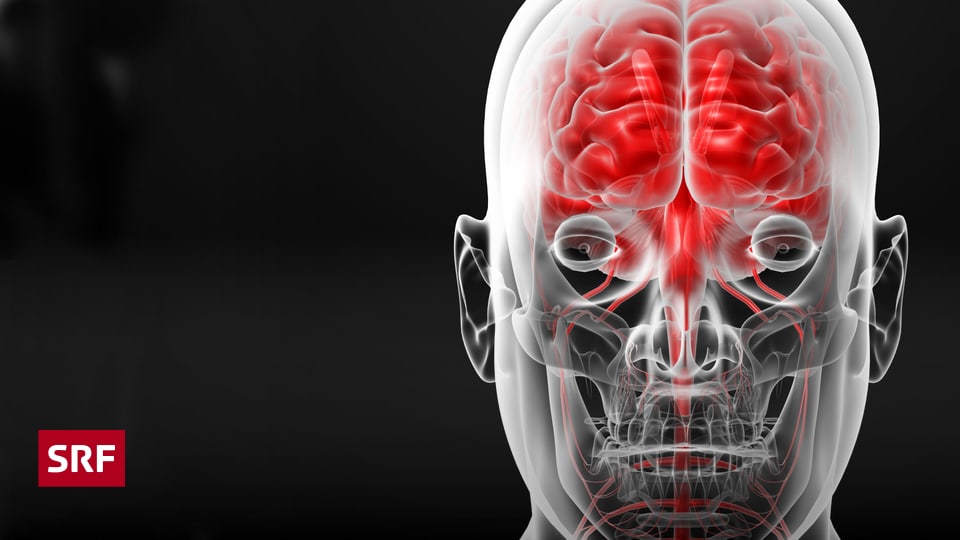 - Präfrontaler Cortex – Der Regisseur im Gehirn - Wissen - SRF