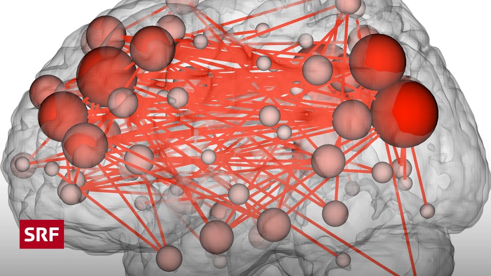 Mensch - Zeigen Gehirnscans, wie intelligent wir sind? - Wissen - SRF