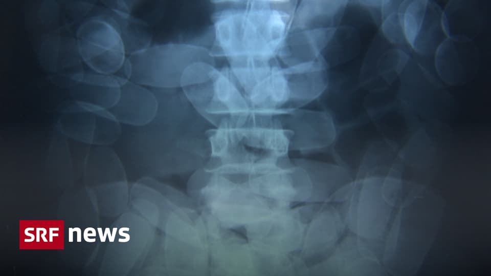 Schweiz - Drogenschmuggel im Körper: Bodypacking boomt - News - SRF