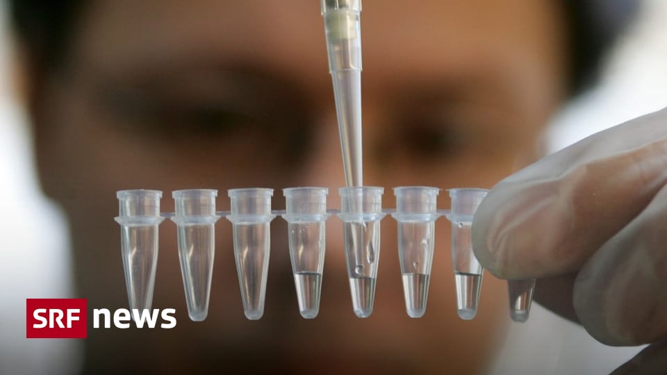 Boomende Gentests - Der Bund warnt vor «Gen-Checks» aus dem Internet ...