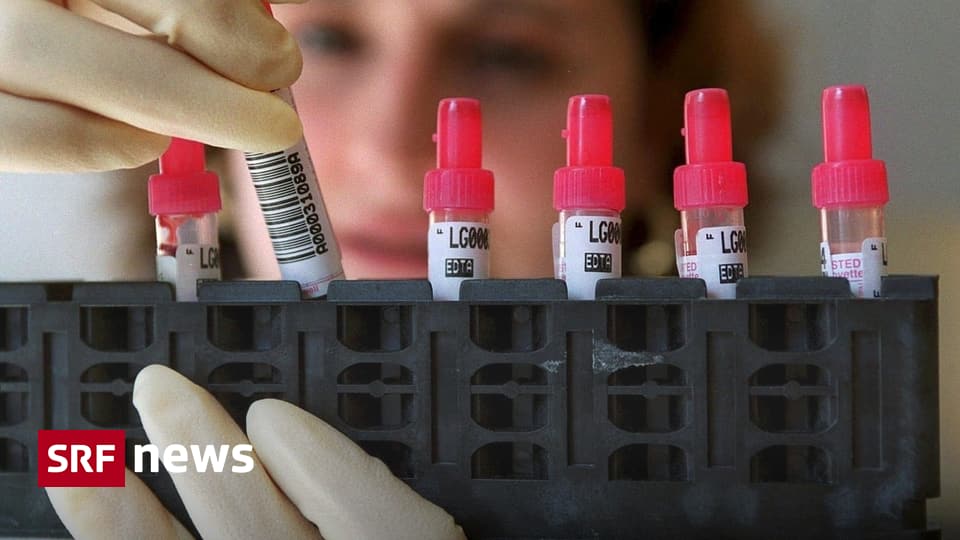 Combating HIV Infections in Switzerland: BAG's Efforts for Zero ...