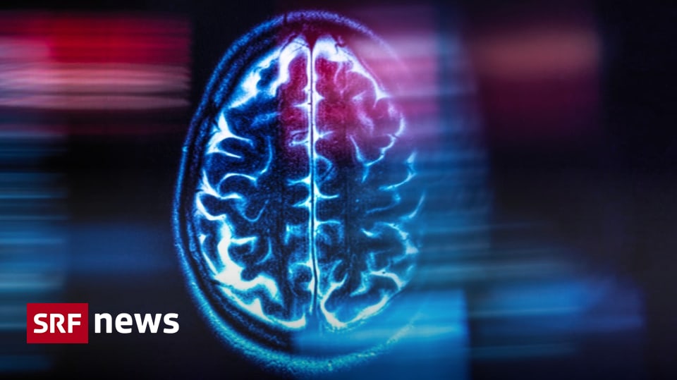 Experiment in den USA - Gedanken entschlüsseln dank Hirn-Scans und KI ...